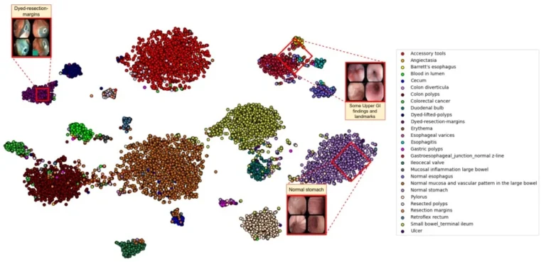 GastroVision: A Multi-class Endoscopy Image Dataset for Computer Aided ...