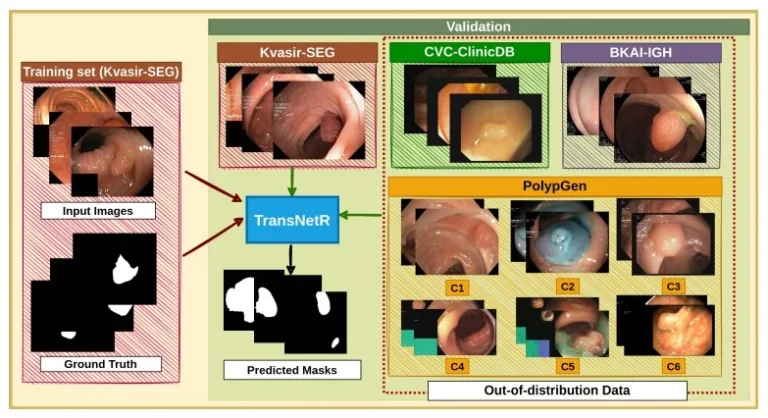Transnetr Transformer Based Residual Network For Polyp Segmentation With Multi Center Out Of